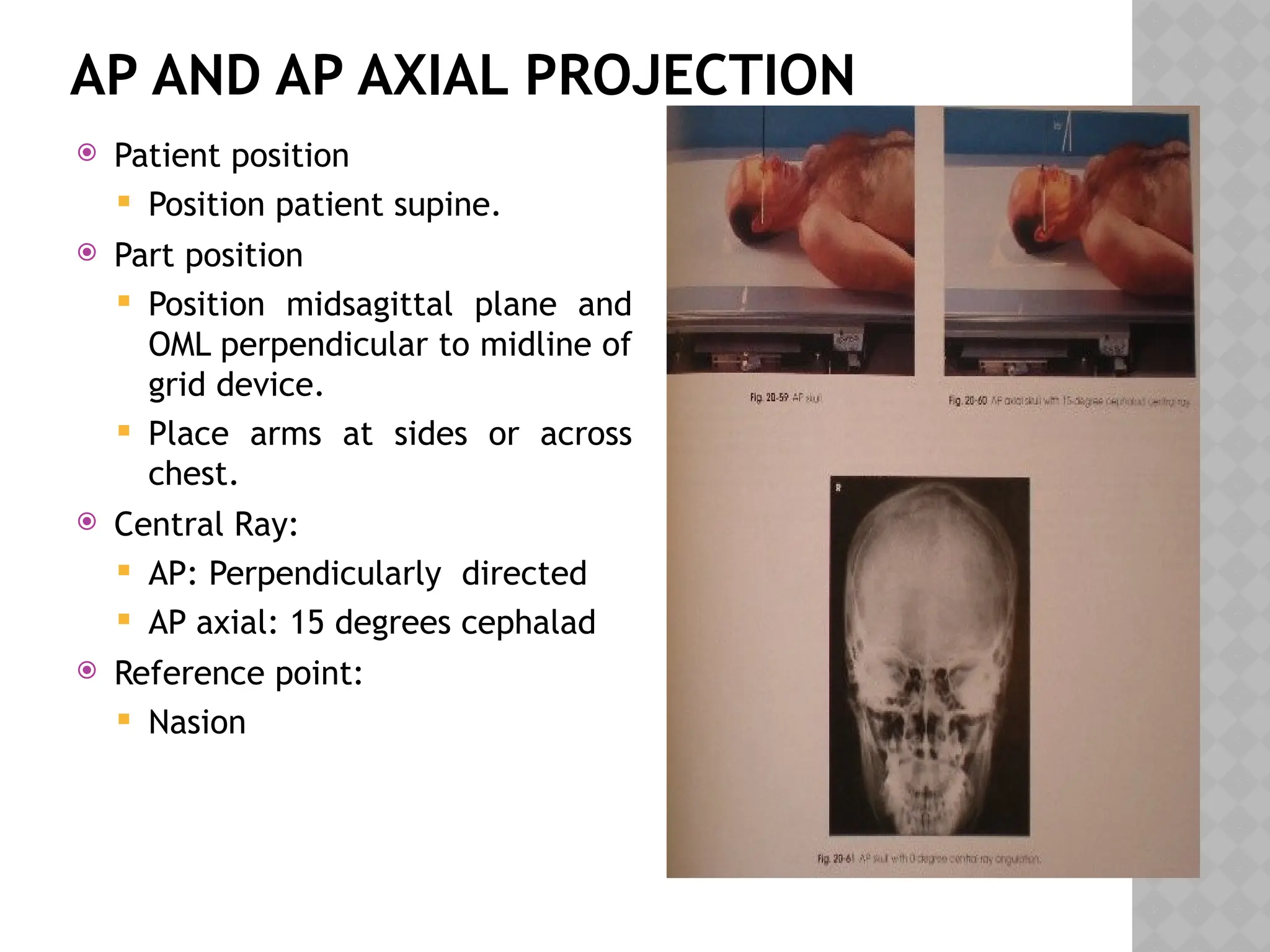 Radiographic positioning II. Skull positioning | PPTX