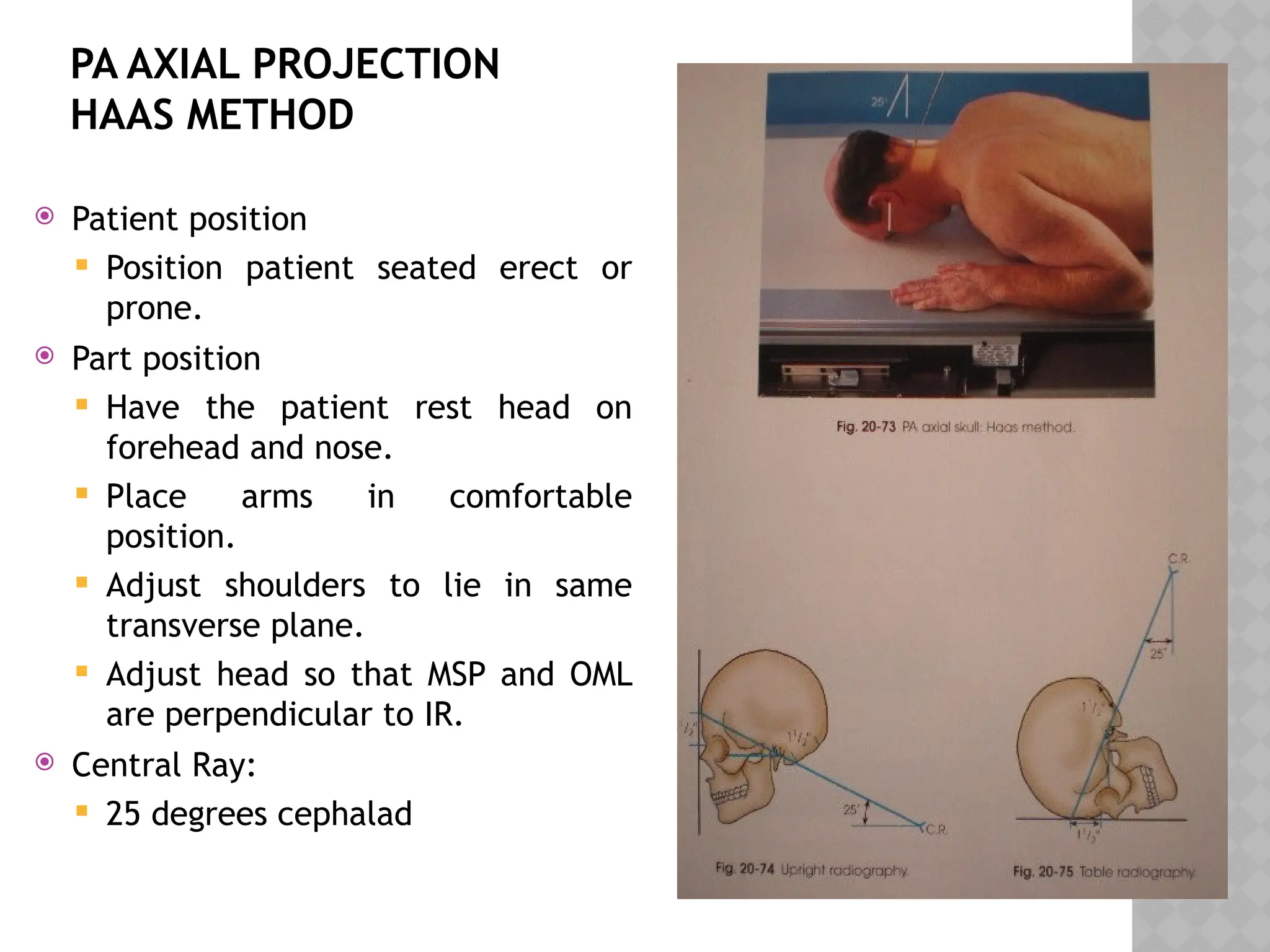 Radiographic positioning II. Skull positioning | PPTX