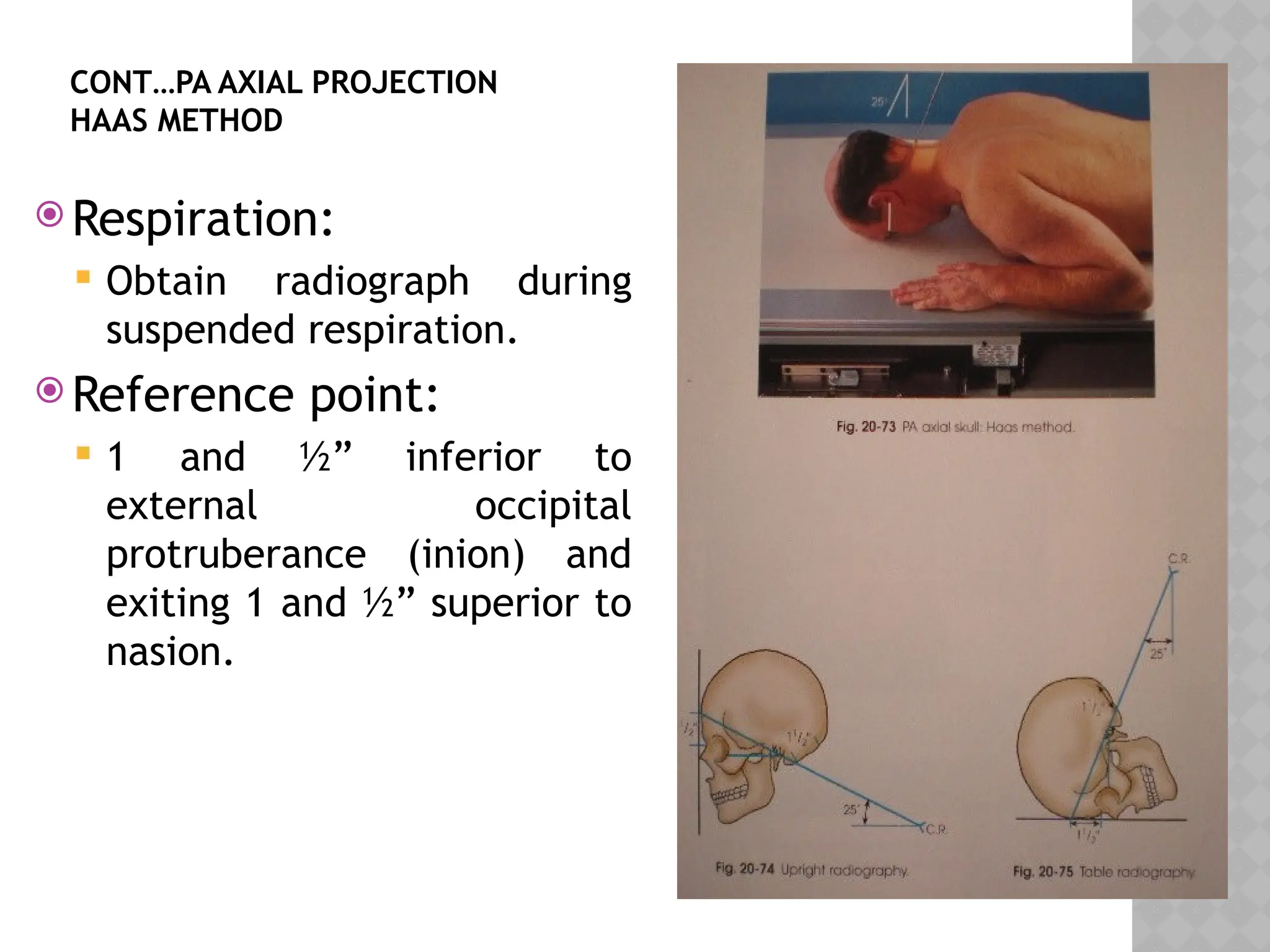 Radiographic positioning II. Skull positioning | PPTX