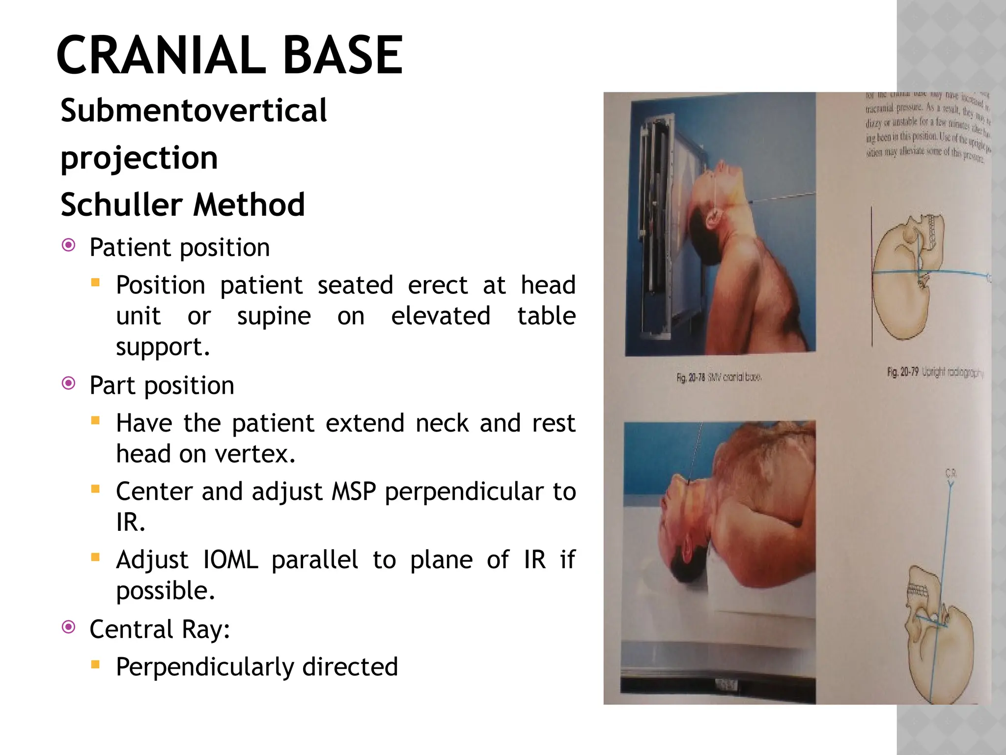 Radiographic positioning II. Skull positioning | PPTX