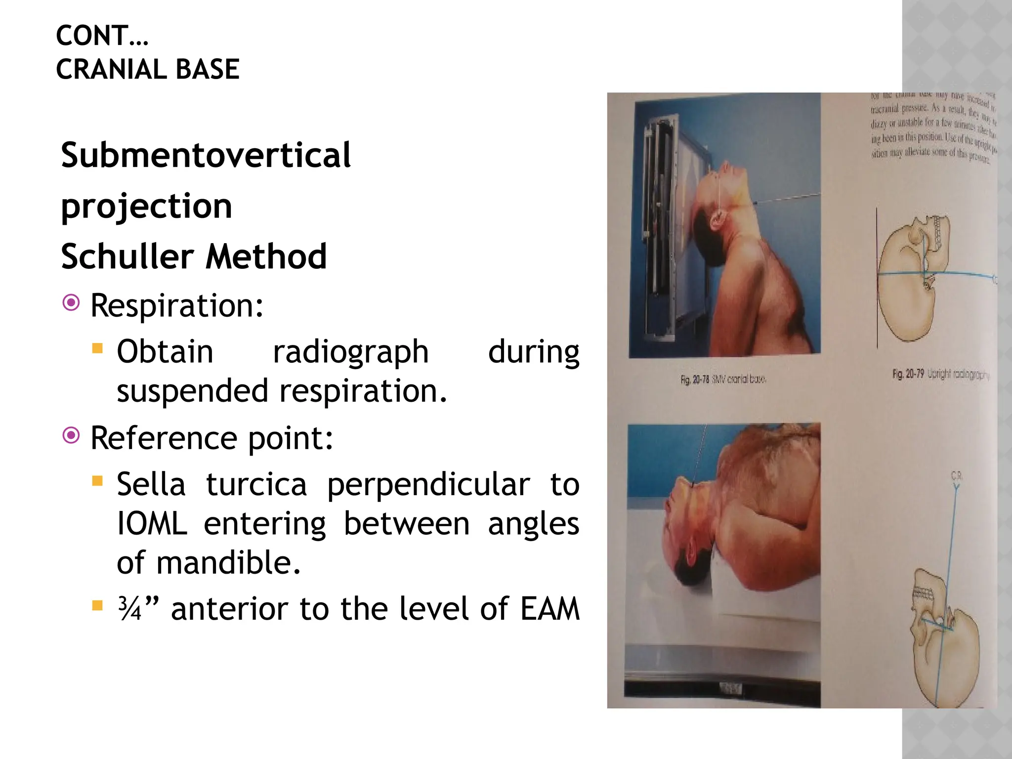 Radiographic positioning II. Skull positioning | PPTX