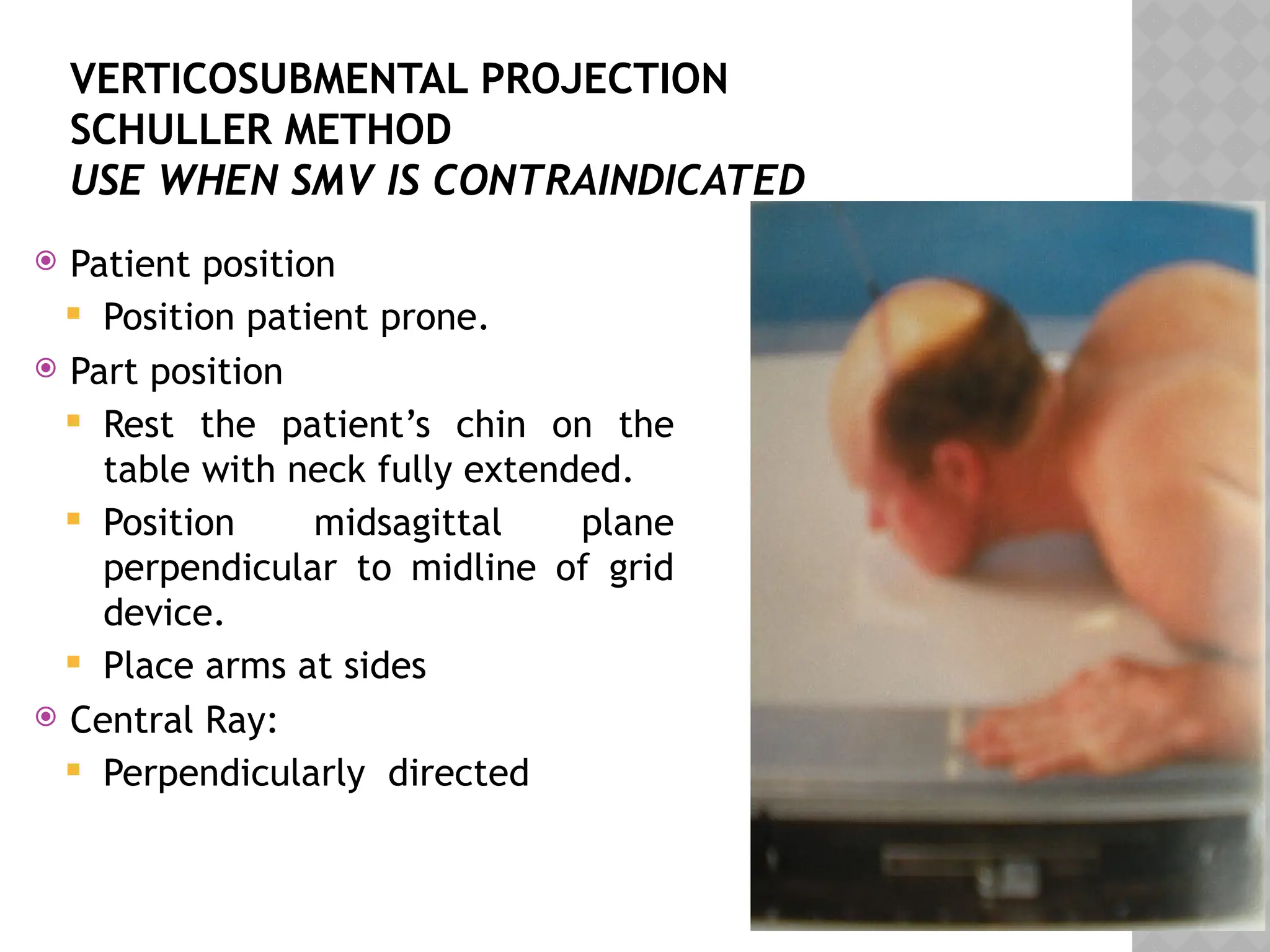 Radiographic positioning II. Skull positioning | PPTX