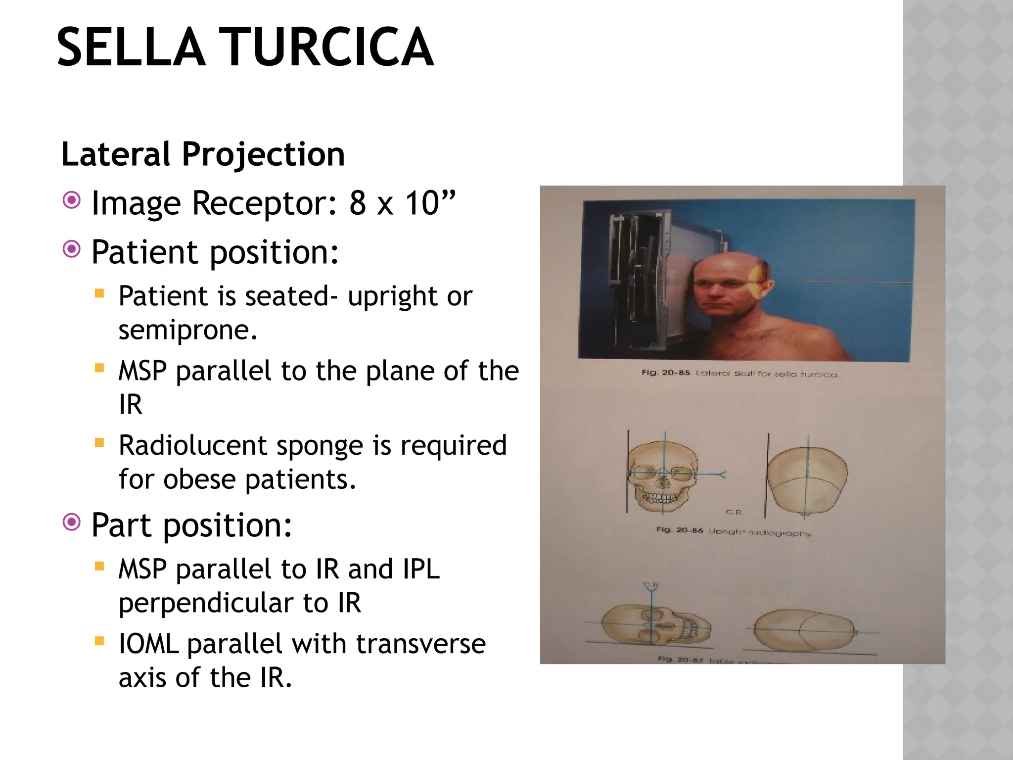 Radiographic positioning II. Skull positioning | PPTX