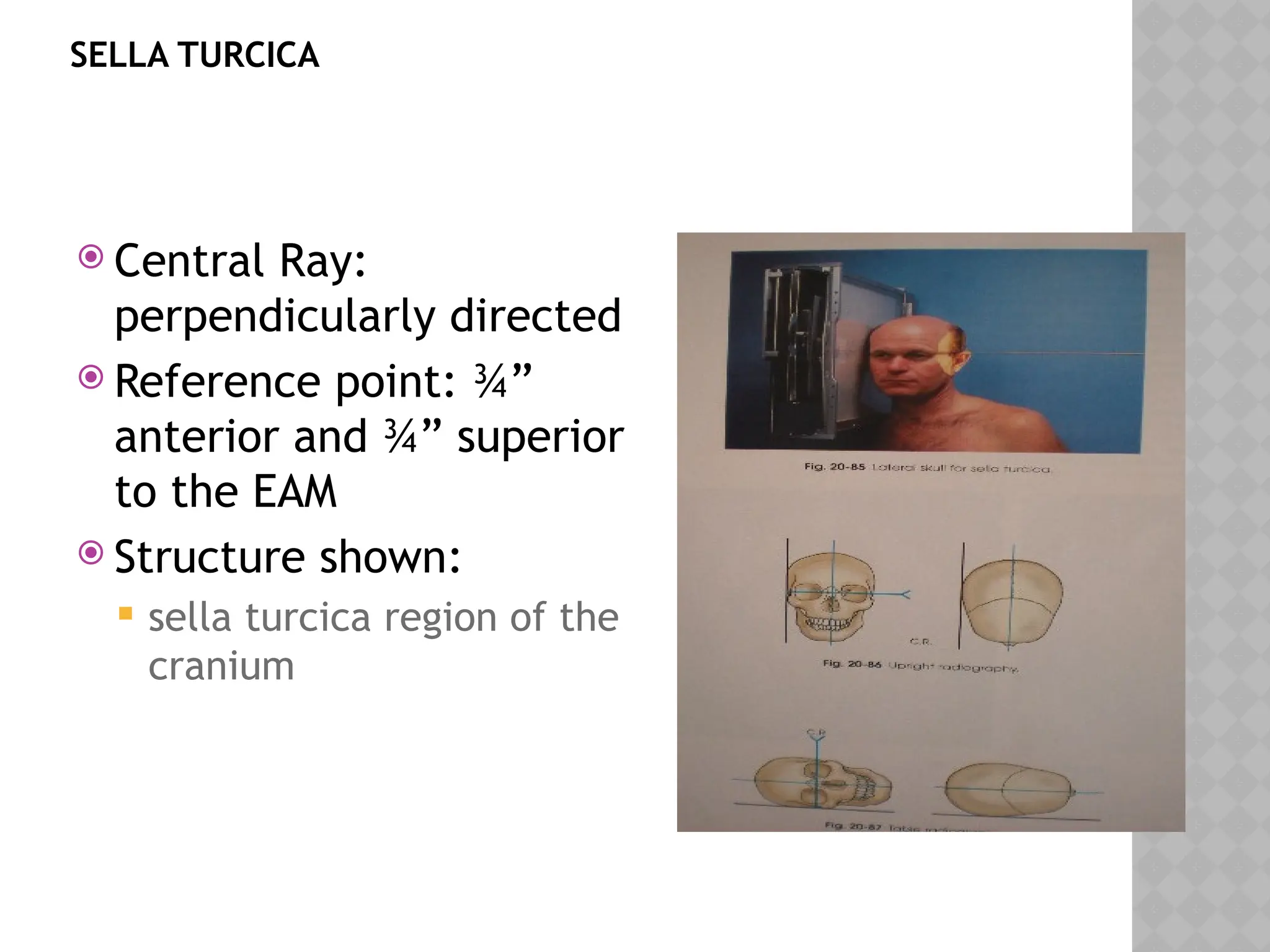 Radiographic positioning II. Skull positioning | PPTX