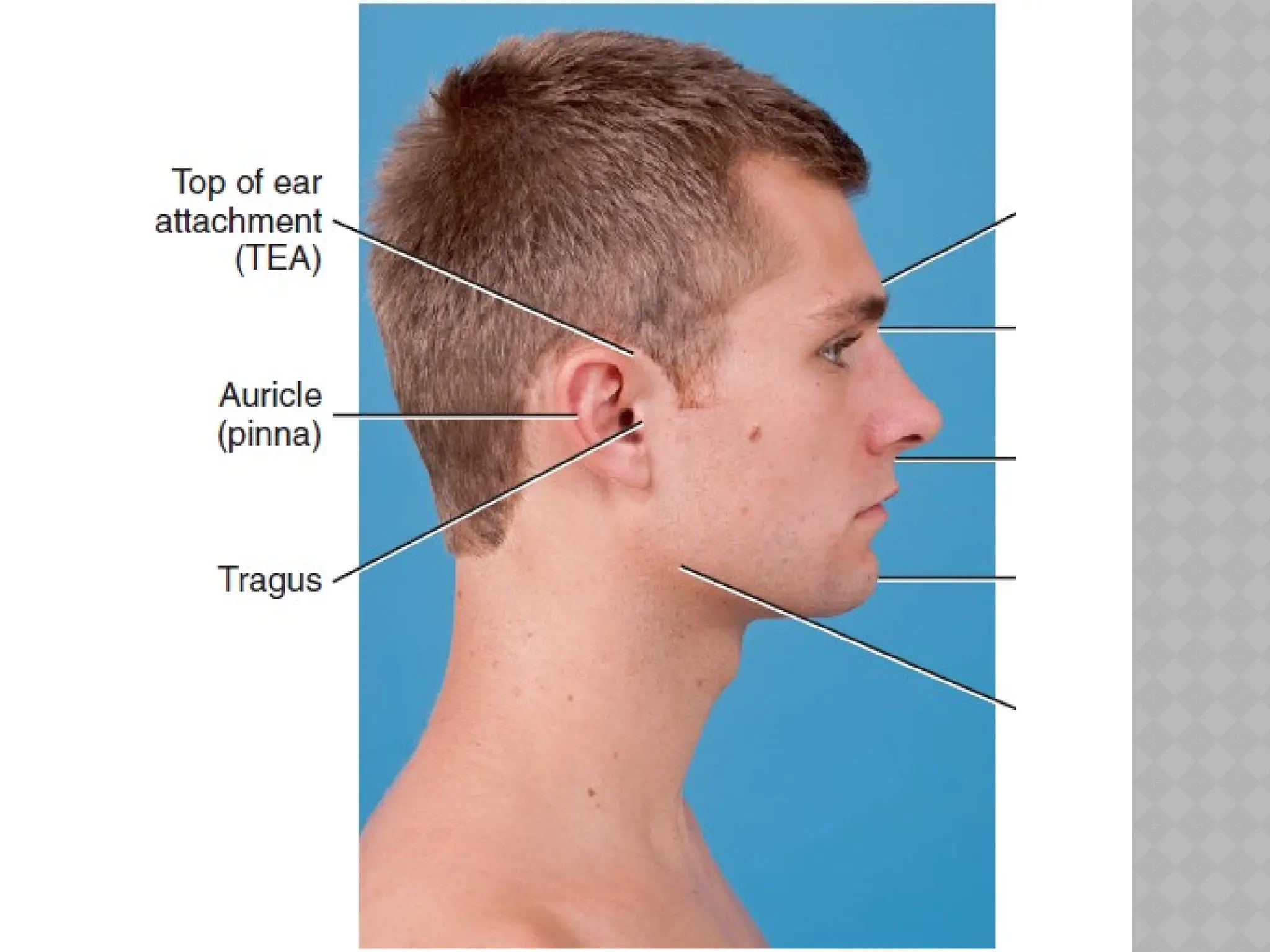 Radiographic positioning II. Skull positioning | PPTX