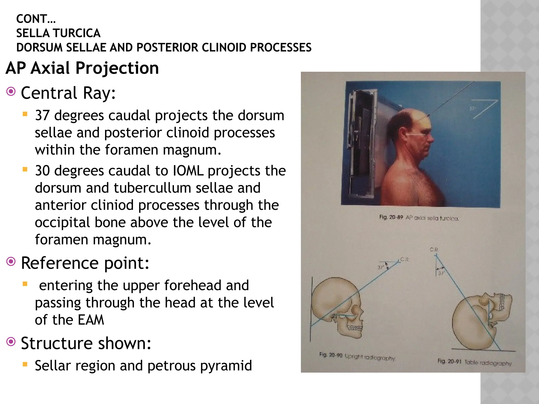 Radiographic positioning II. Skull positioning | PPTX