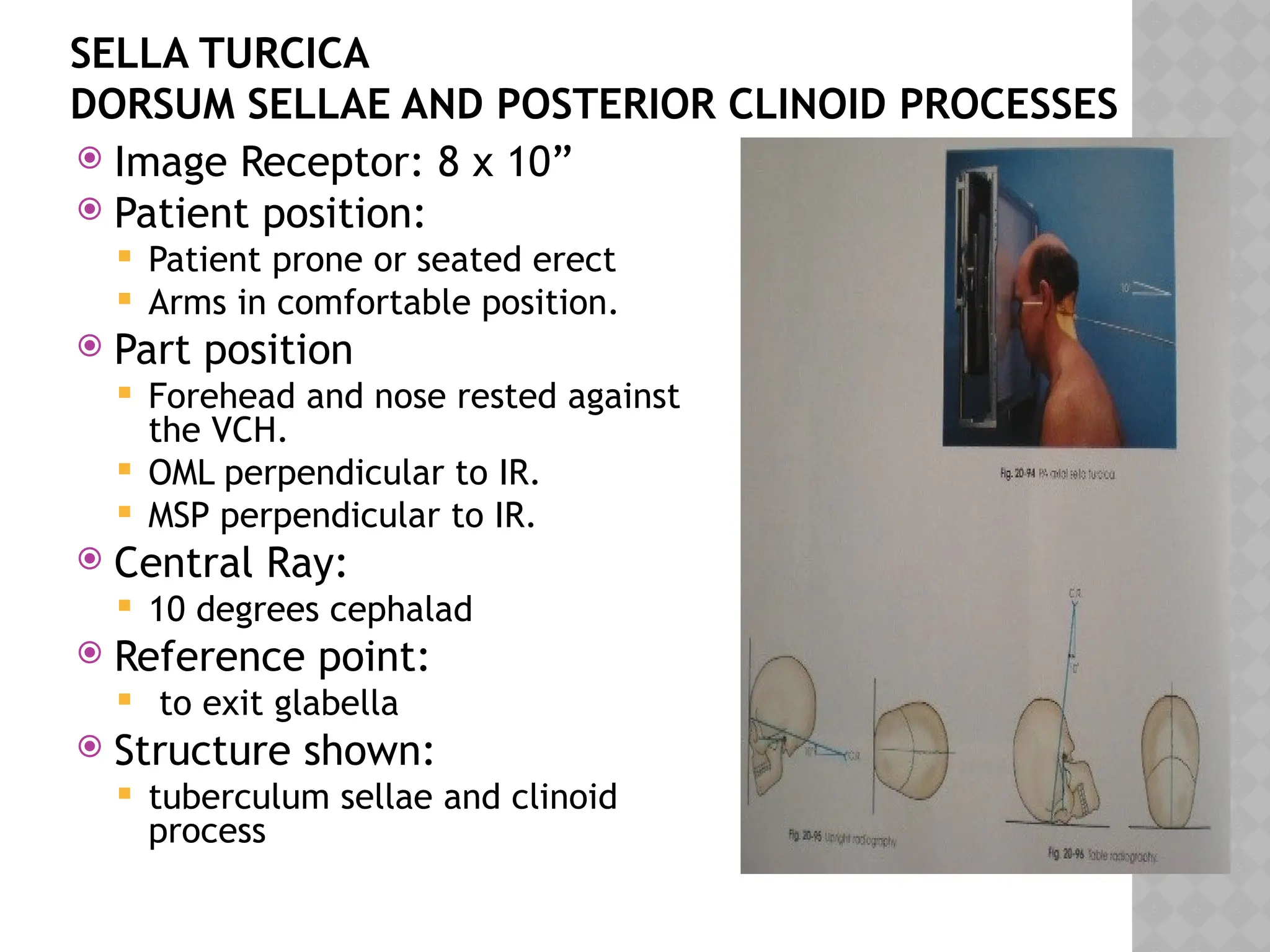 Radiographic positioning II. Skull positioning | PPTX