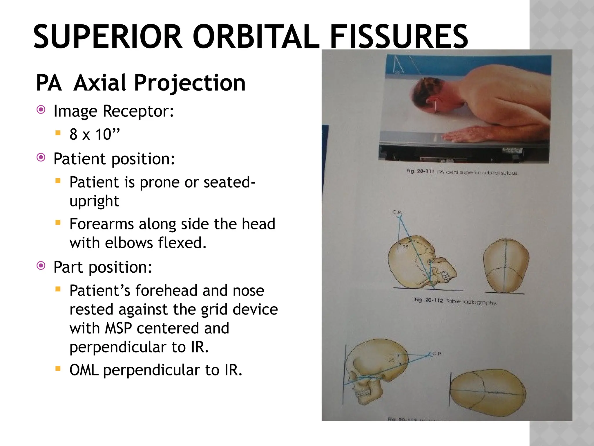 Radiographic positioning II. Skull positioning | PPTX
