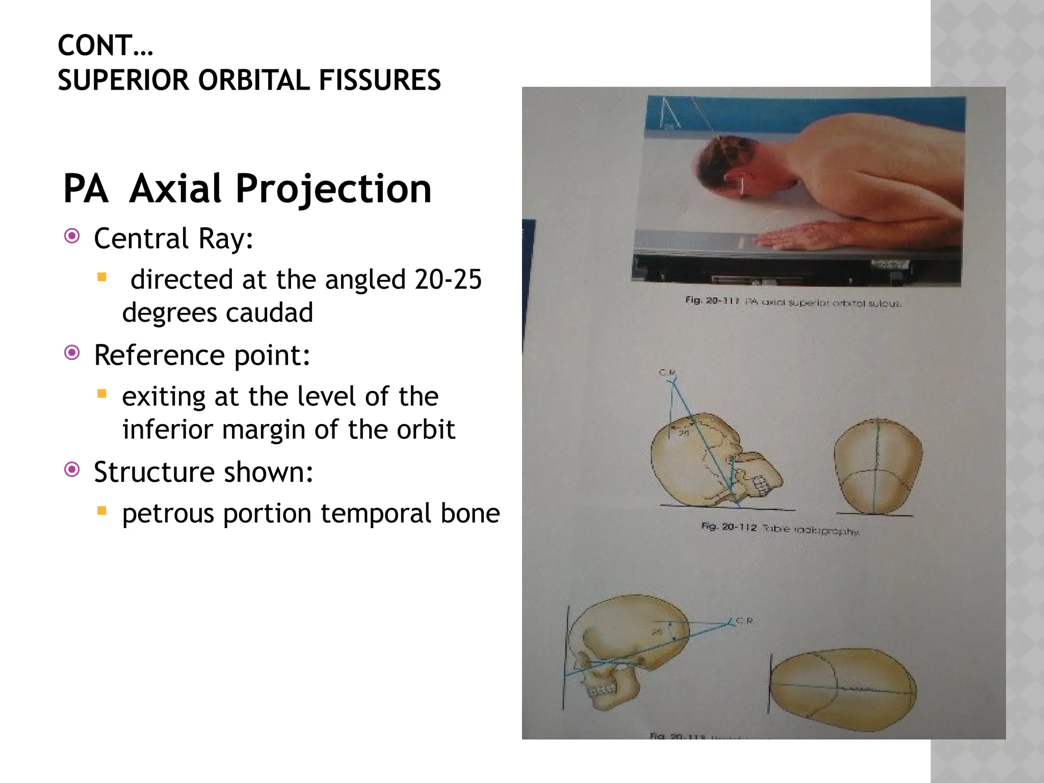 Radiographic positioning II. Skull positioning | PPTX