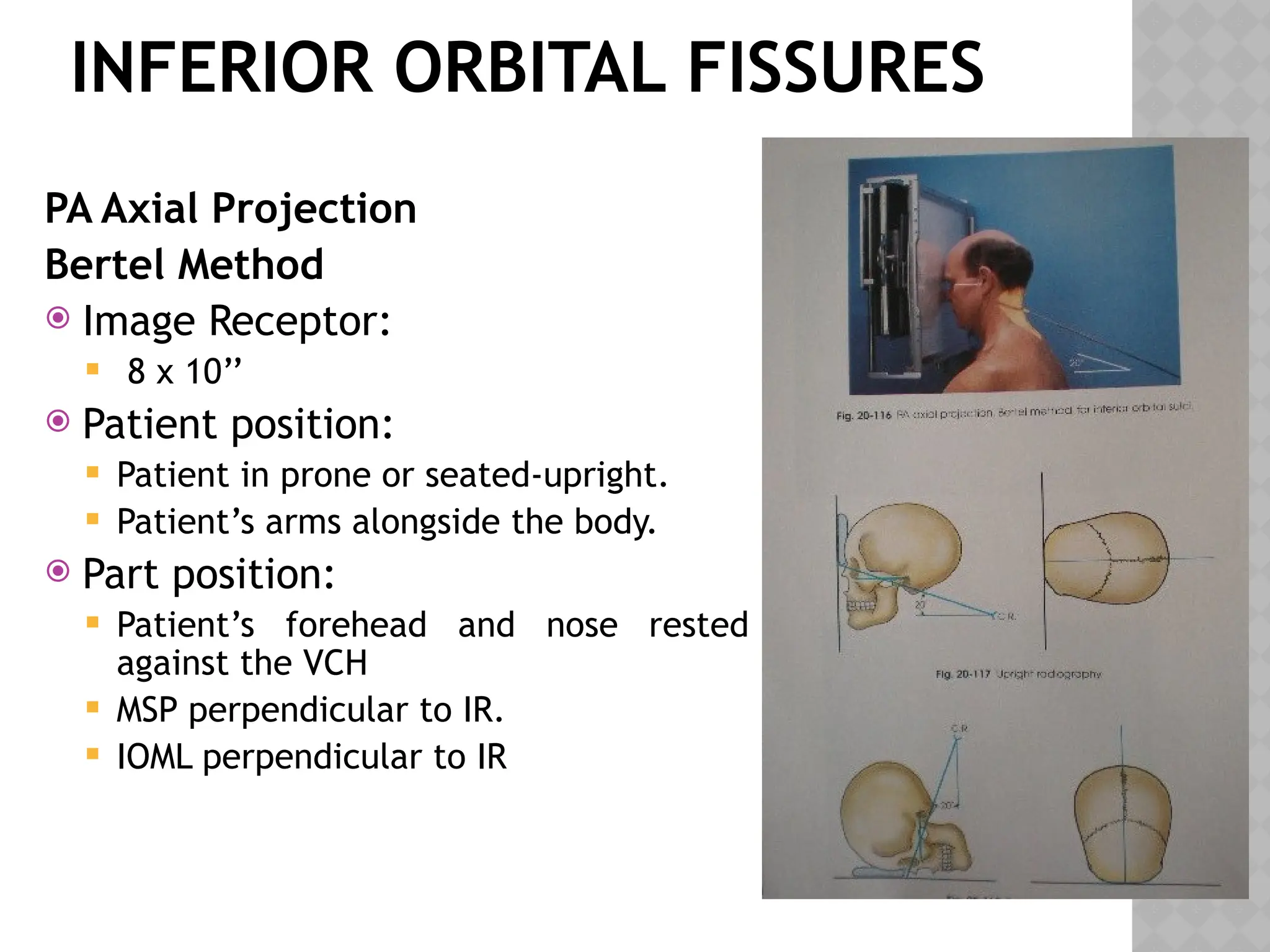 Radiographic positioning II. Skull positioning | PPTX