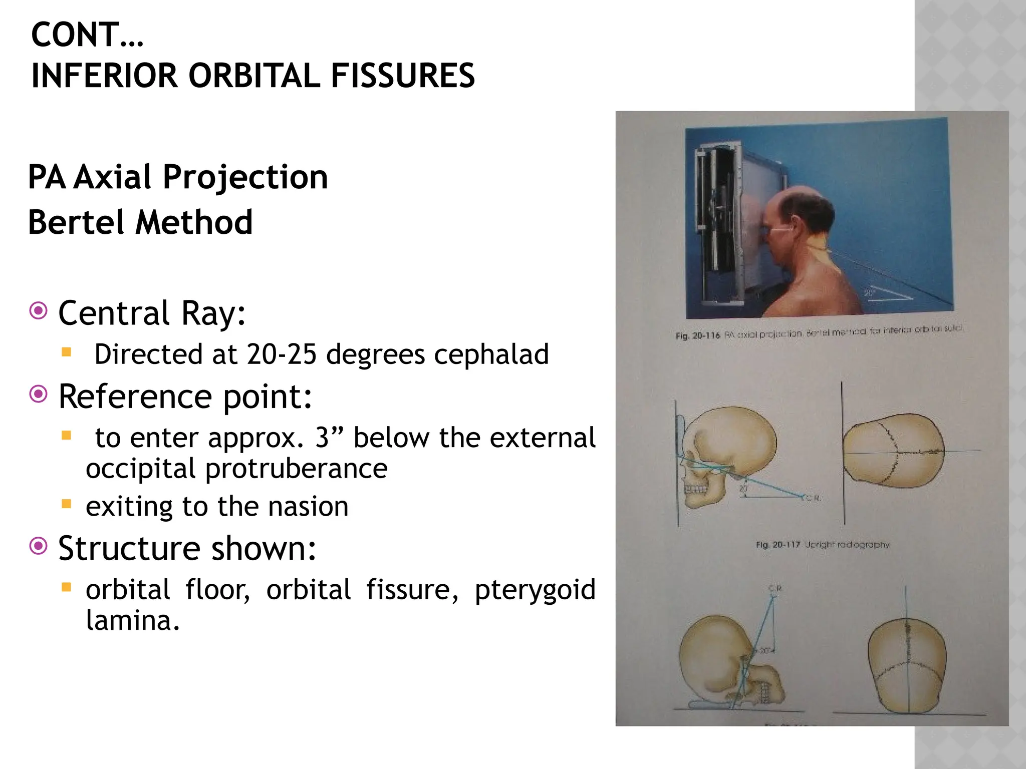 Radiographic positioning II. Skull positioning | PPTX