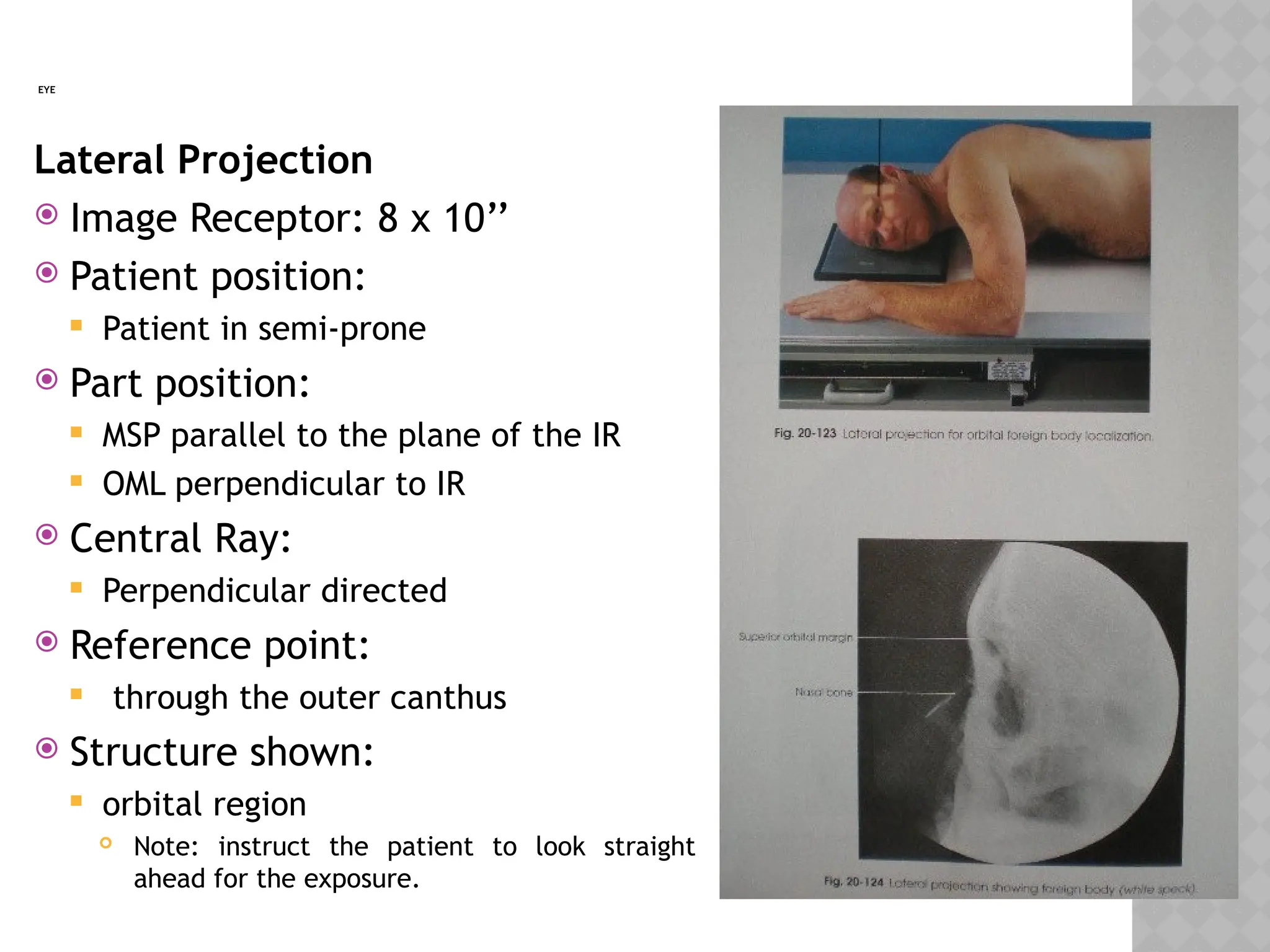 Radiographic positioning II. Skull positioning | PPTX