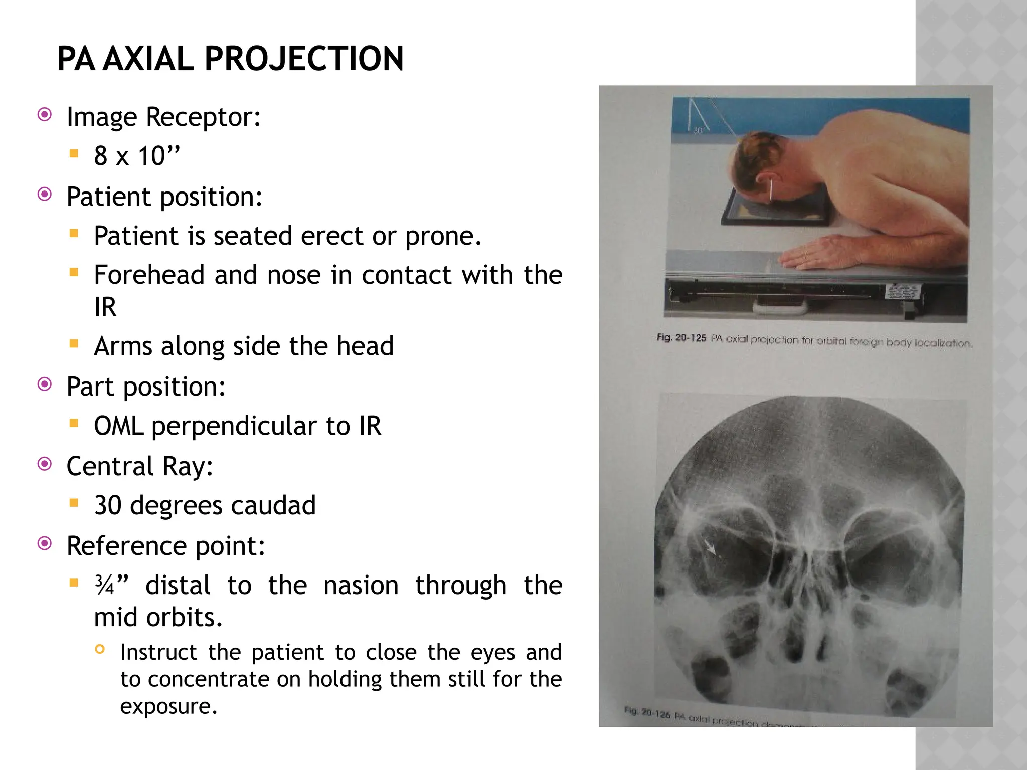 Radiographic positioning II. Skull positioning | PPTX