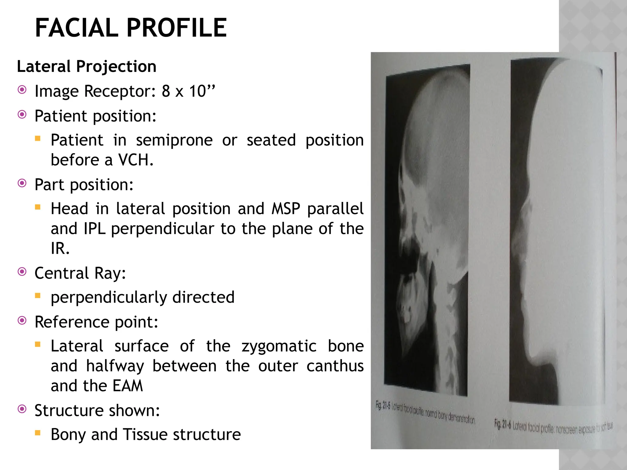 Radiographic positioning II. Skull positioning | PPTX