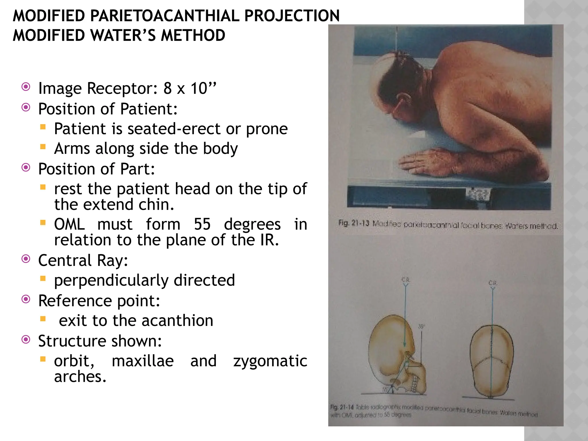 Radiographic positioning II. Skull positioning | PPTX