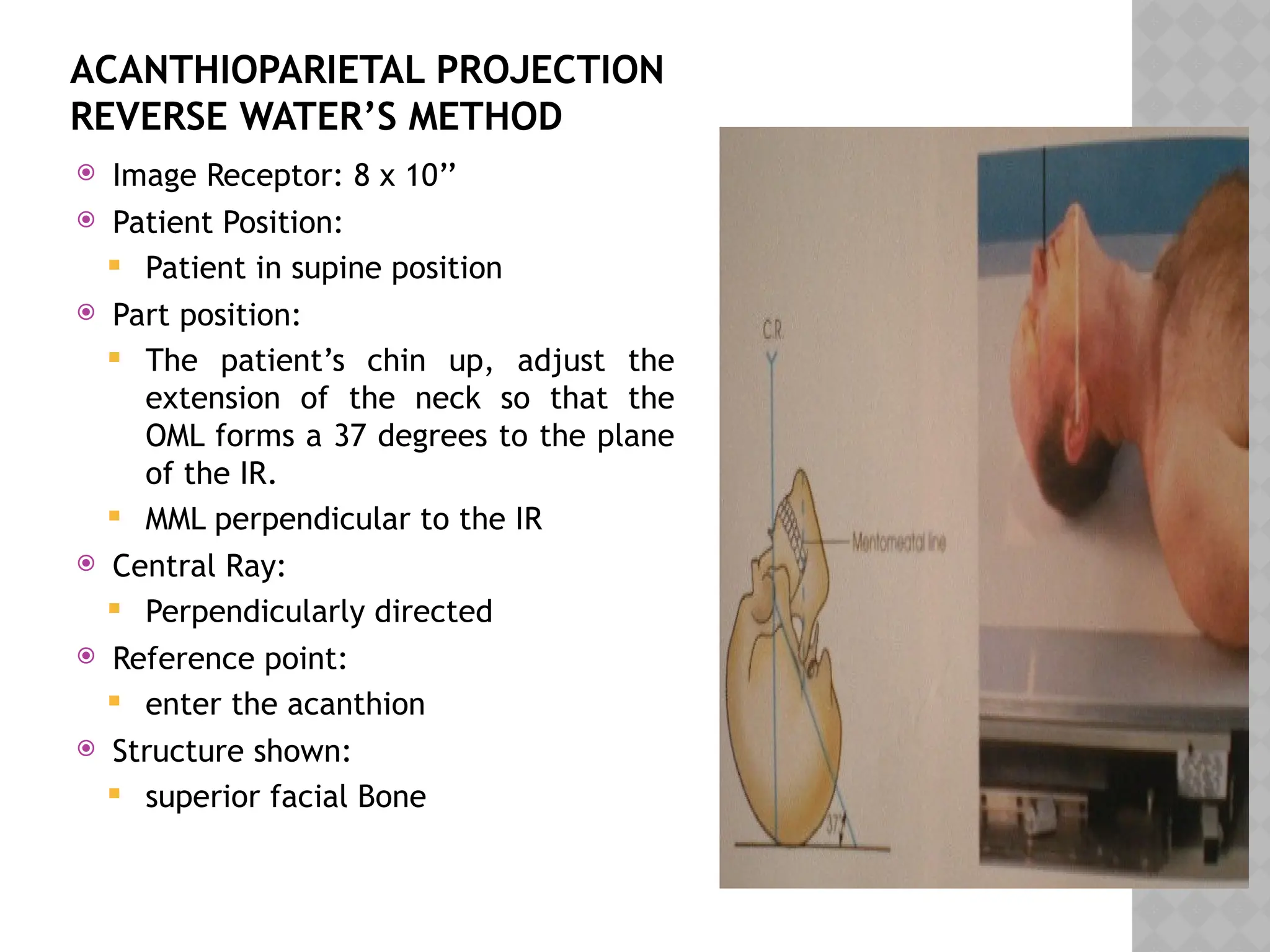 Radiographic positioning II. Skull positioning | PPTX
