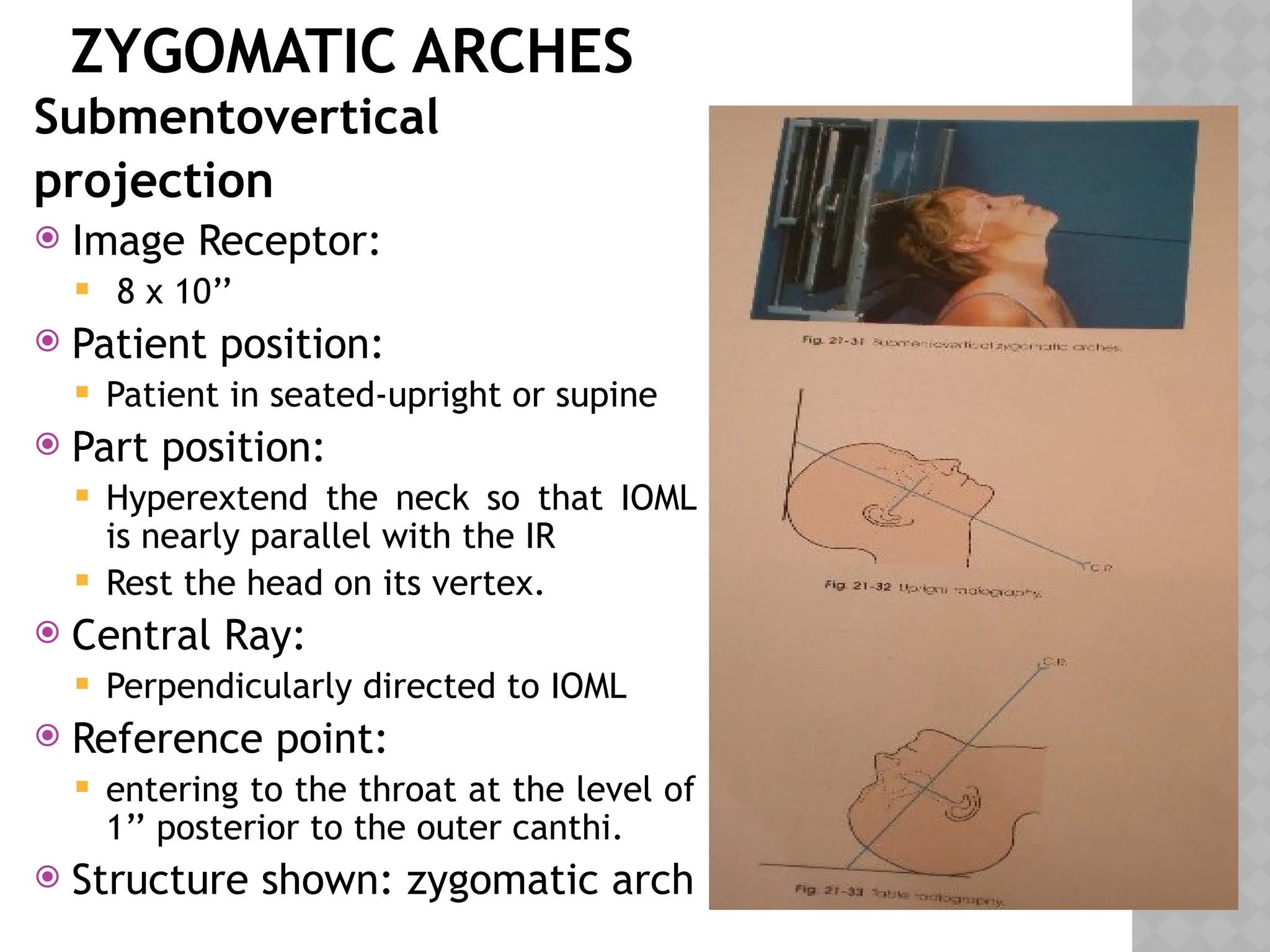 Radiographic positioning II. Skull positioning | PPTX