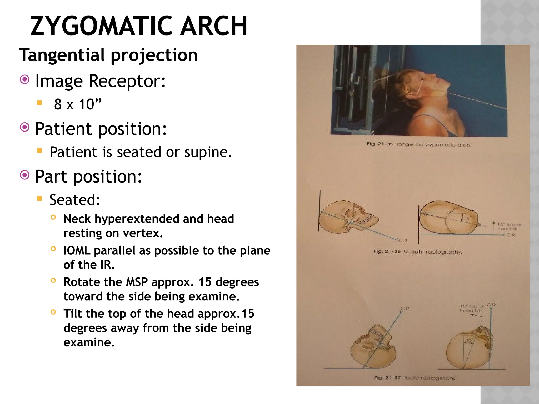 Radiographic positioning II. Skull positioning | PPTX