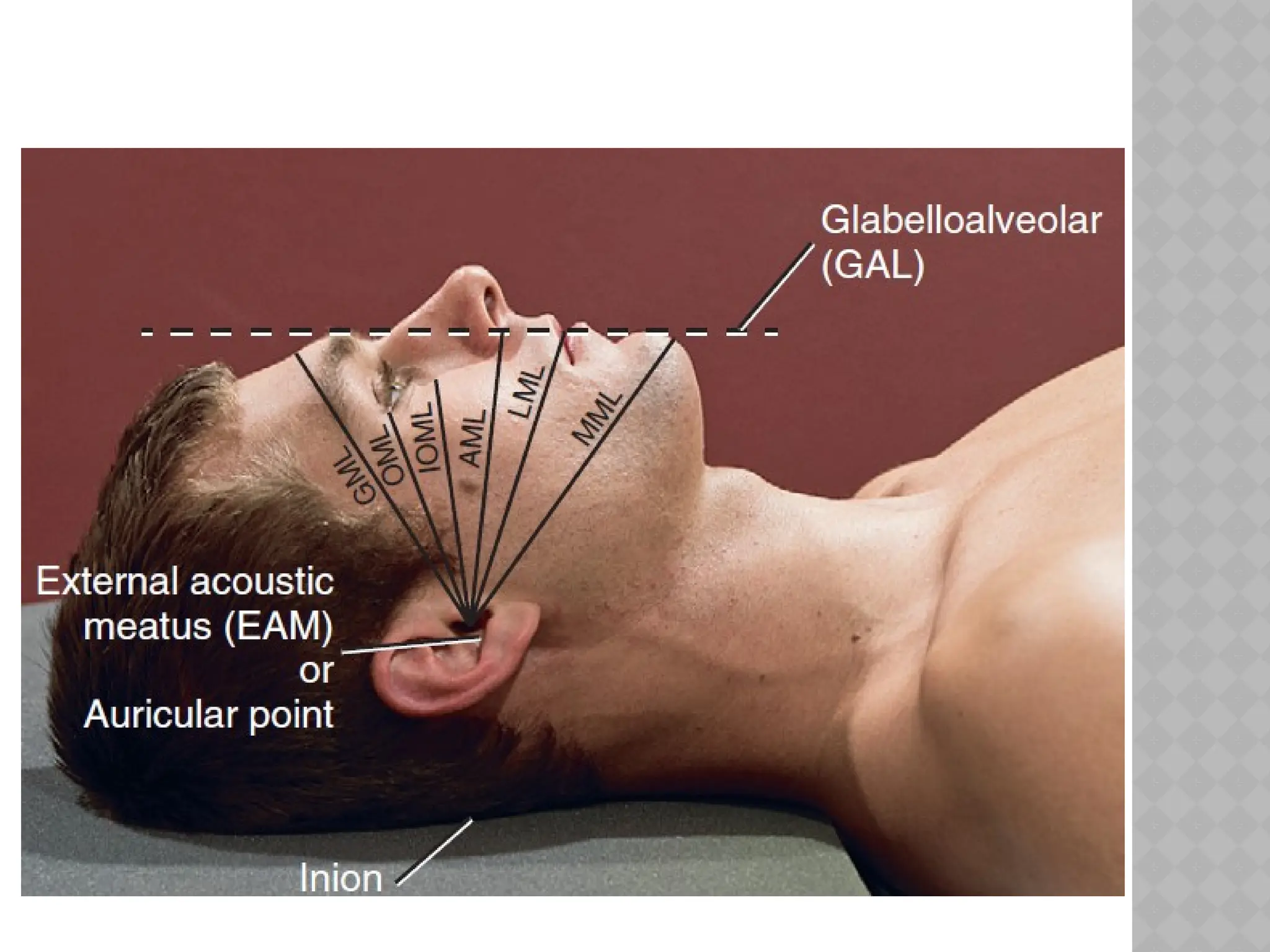 Radiographic positioning II. Skull positioning | PPTX