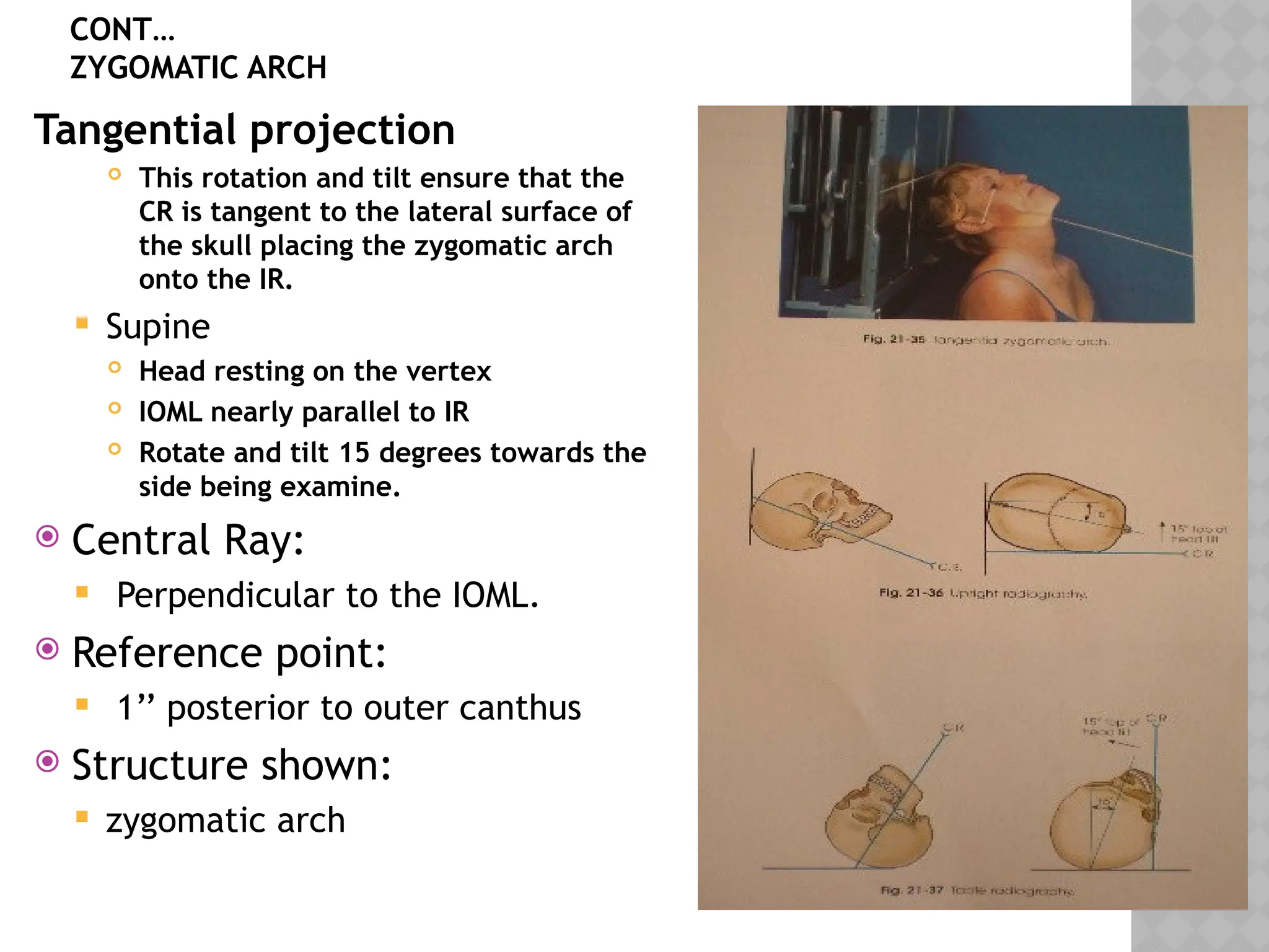 Radiographic positioning II. Skull positioning | PPTX