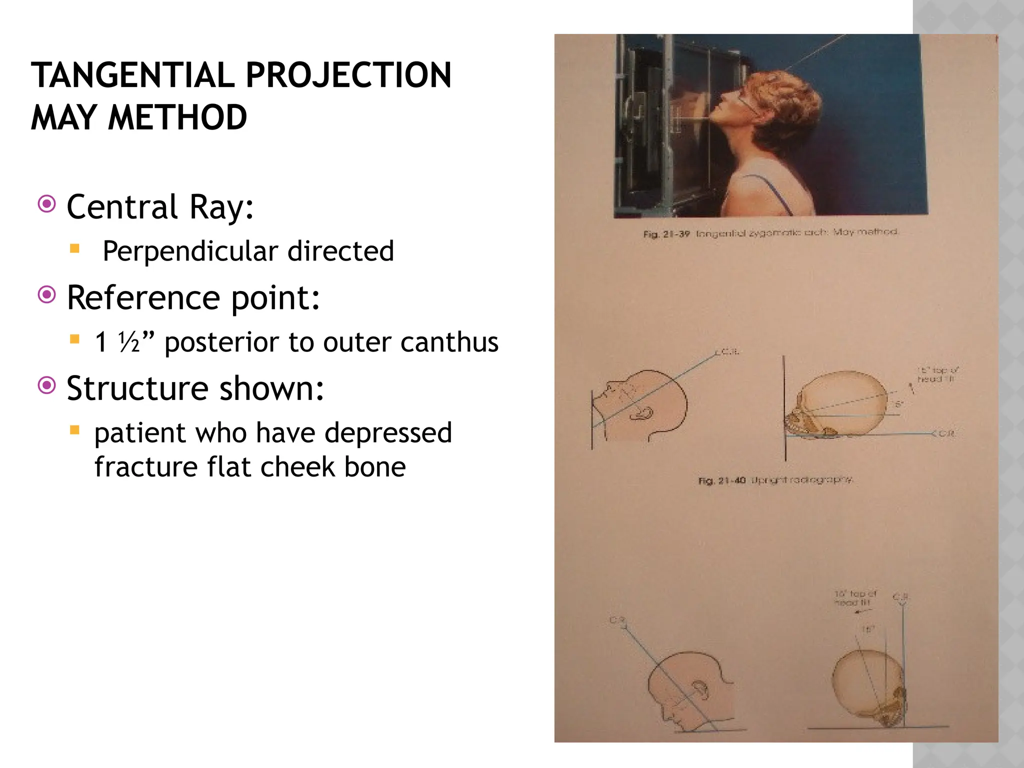 Radiographic positioning II. Skull positioning | PPTX