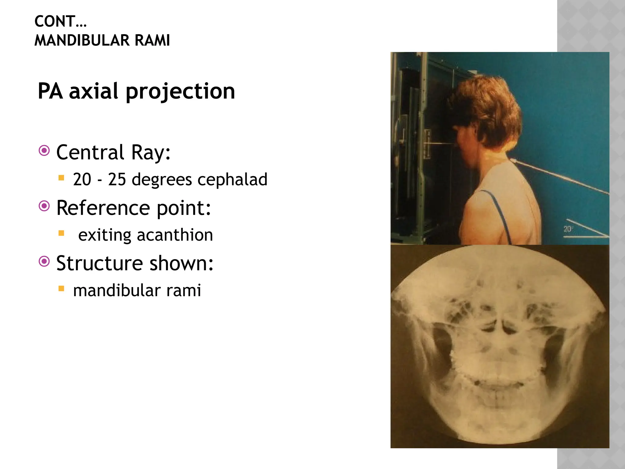 Radiographic positioning II. Skull positioning | PPTX