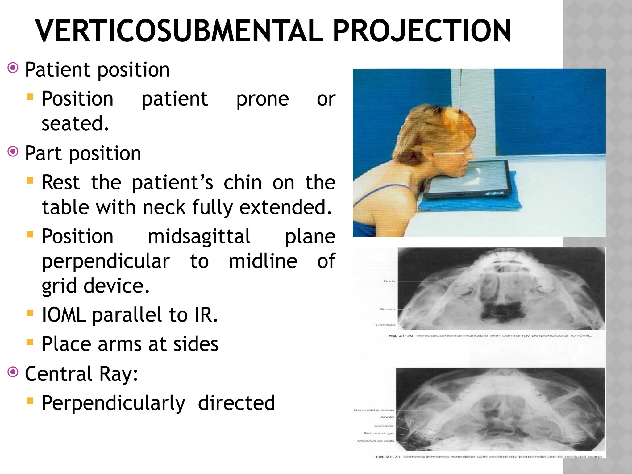 Radiographic positioning II. Skull positioning | PPTX