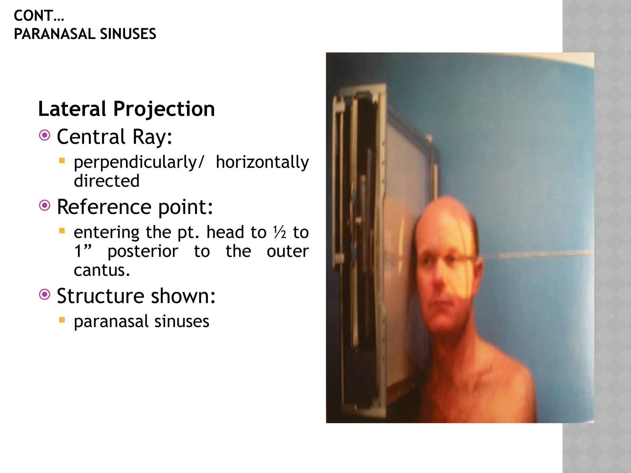 Radiographic positioning II. Skull positioning | PPTX