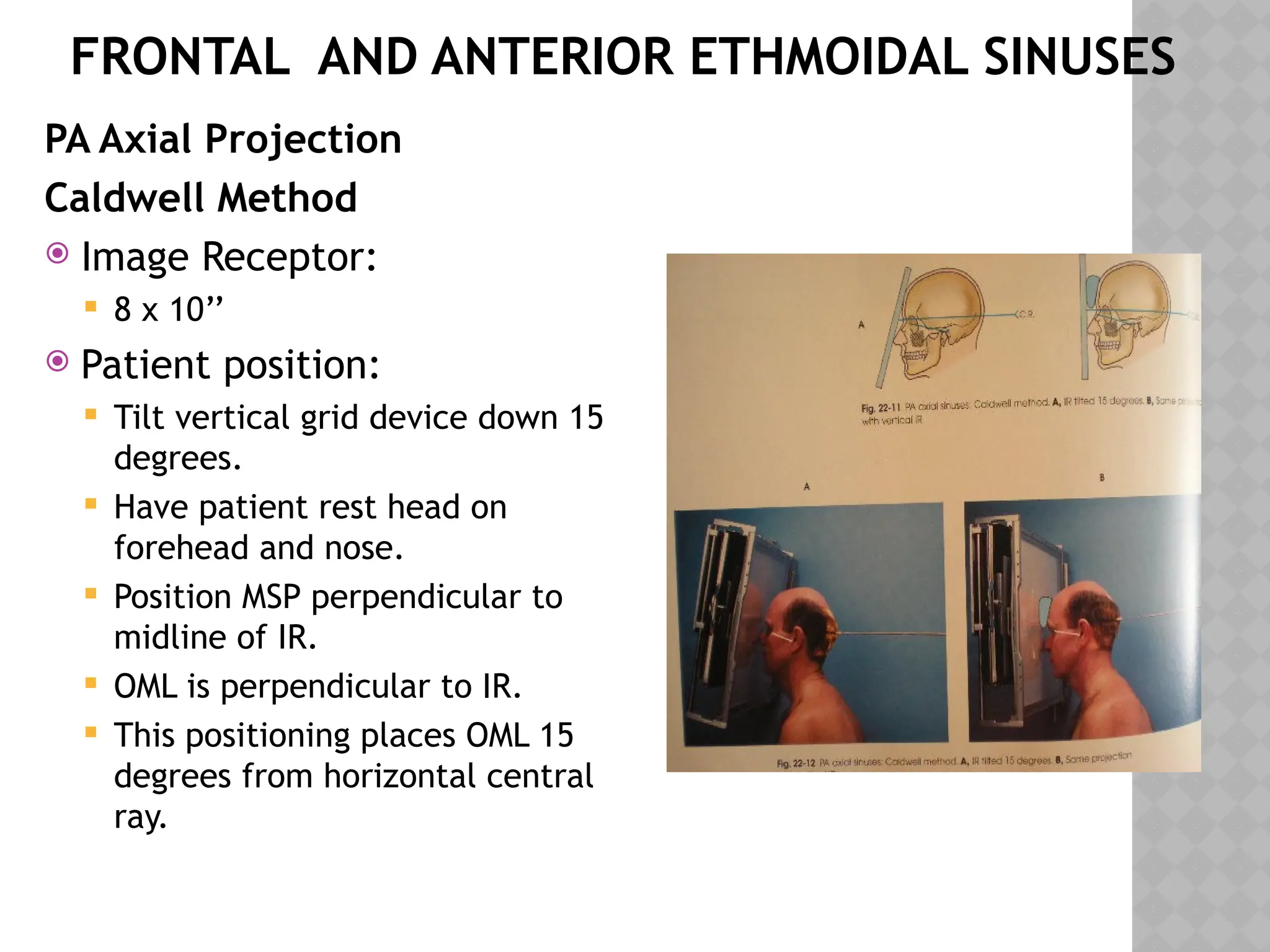 Radiographic positioning II. Skull positioning | PPTX