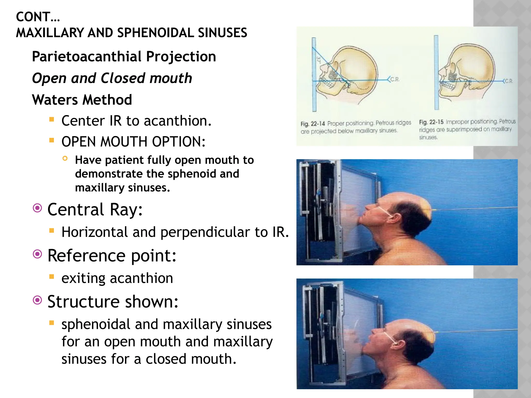 Radiographic positioning II. Skull positioning | PPTX
