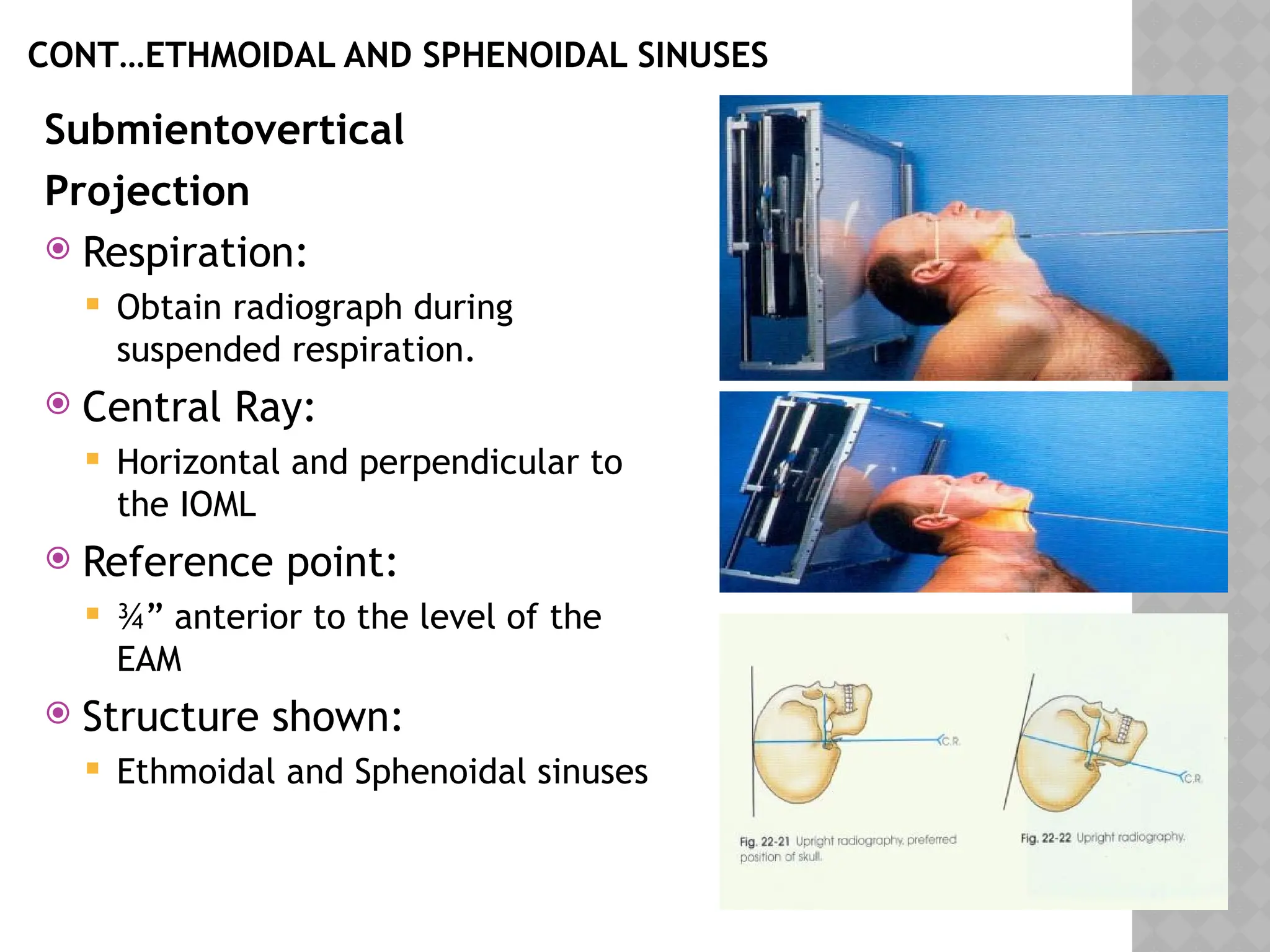 Radiographic positioning II. Skull positioning | PPTX