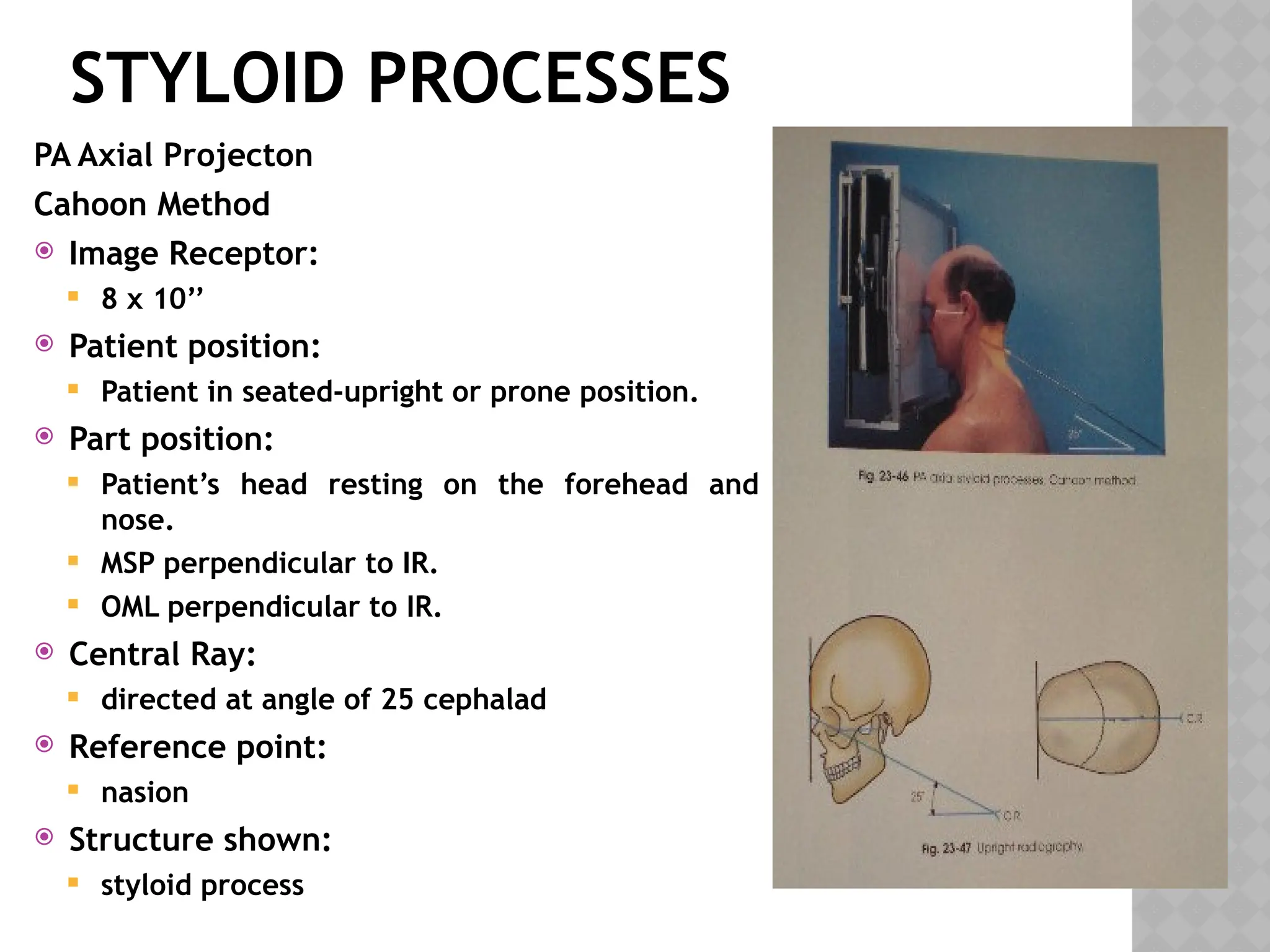 Radiographic positioning II. Skull positioning | PPTX
