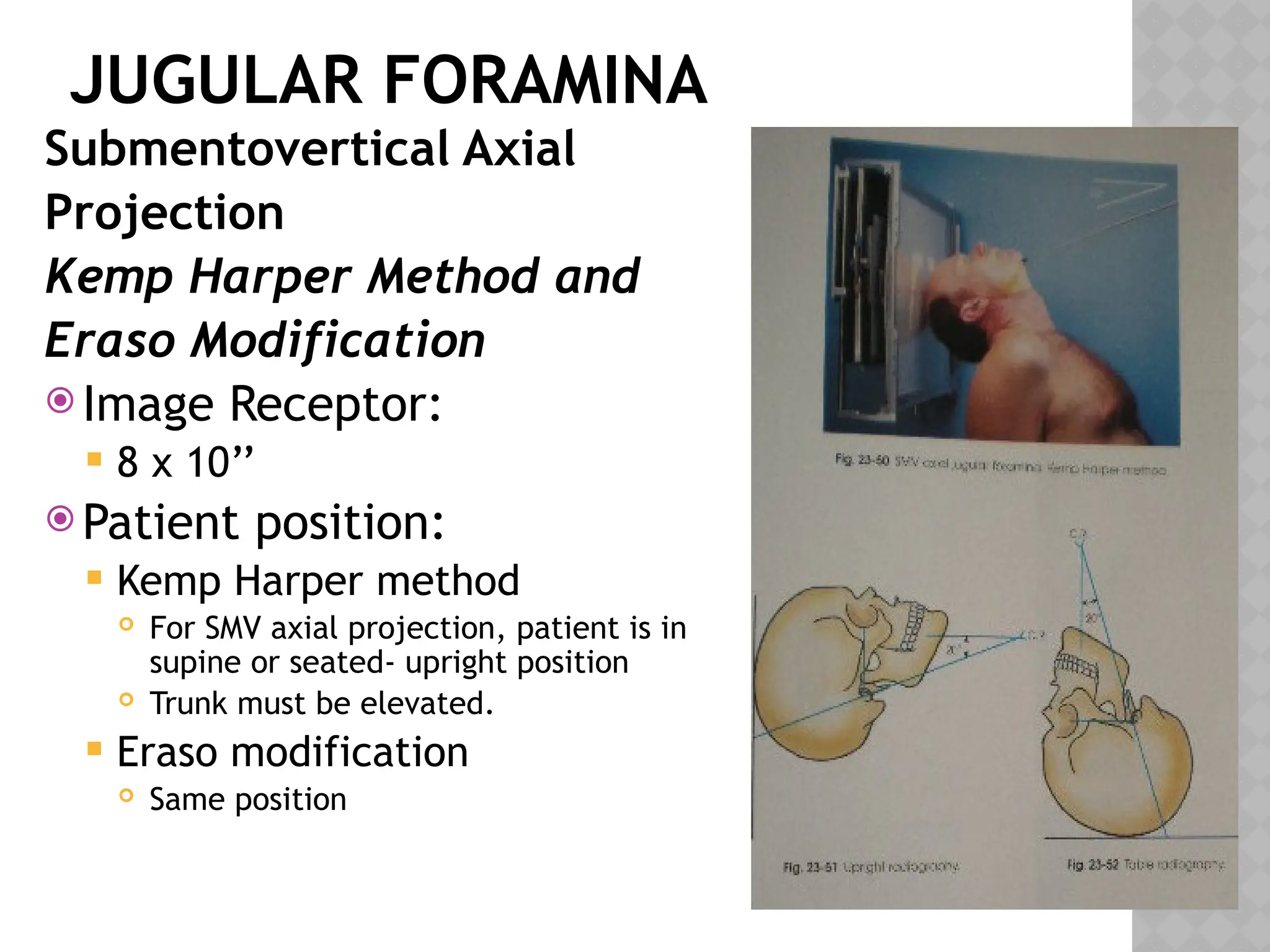 Radiographic positioning II. Skull positioning | PPTX