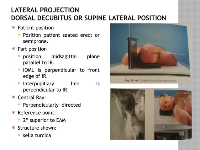 Radiographic positioning II. Skull positioning | PPTX
