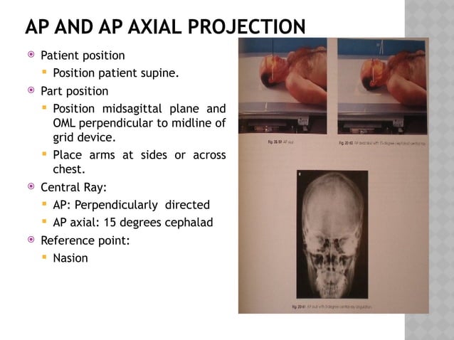 Radiographic positioning II. Skull positioning | PPTX