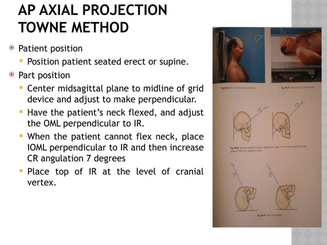 Radiographic positioning II. Skull positioning | PPTX