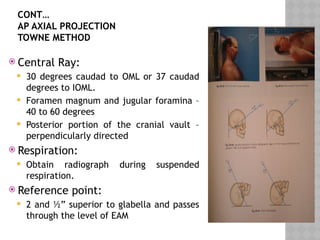 Radiographic positioning II. Skull positioning | PPTX