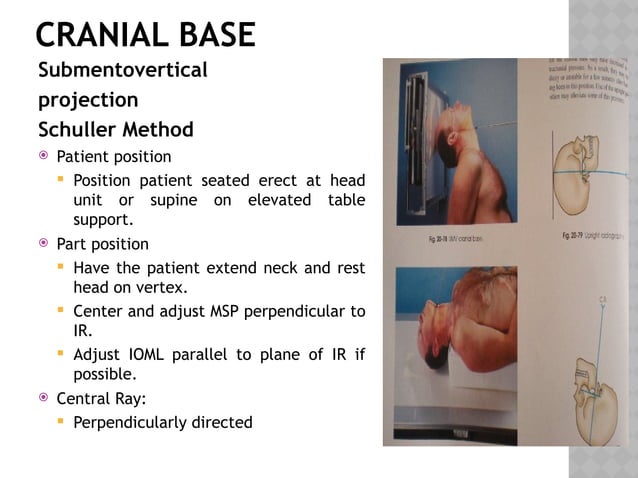Radiographic positioning II. Skull positioning | PPTX