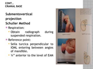 Radiographic positioning II. Skull positioning | PPTX