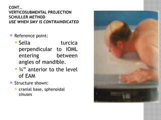 Radiographic positioning II. Skull positioning | PPTX
