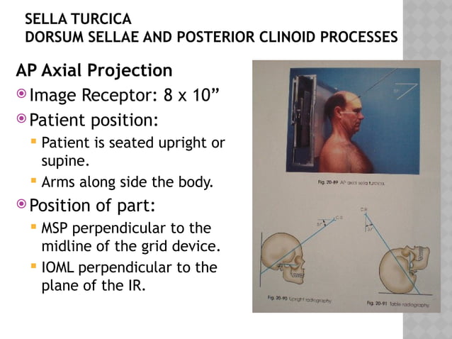 Radiographic positioning II. Skull positioning | PPTX