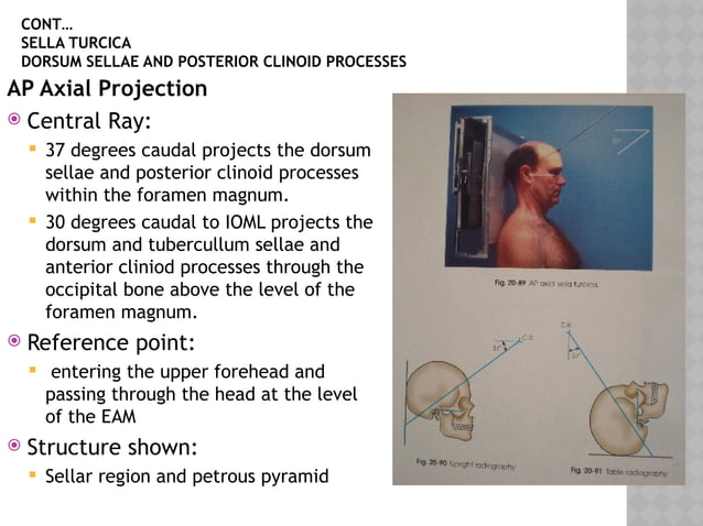 Radiographic positioning II. Skull positioning | PPTX