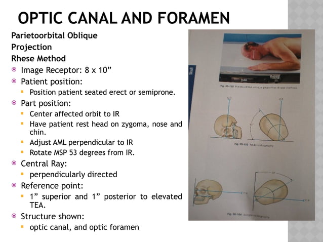 Radiographic positioning II. Skull positioning | PPTX