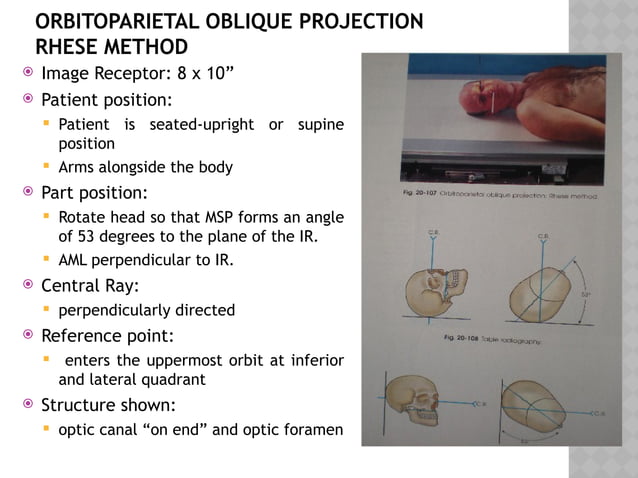 Radiographic positioning II. Skull positioning | PPT