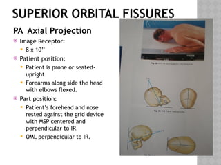 Radiographic positioning II. Skull positioning | PPTX
