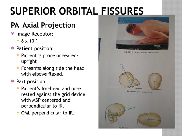 Radiographic positioning II. Skull positioning | PPT