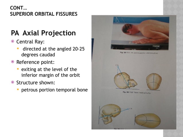 Radiographic positioning II. Skull positioning | PPTX