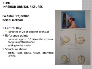 Radiographic positioning II. Skull positioning | PPTX
