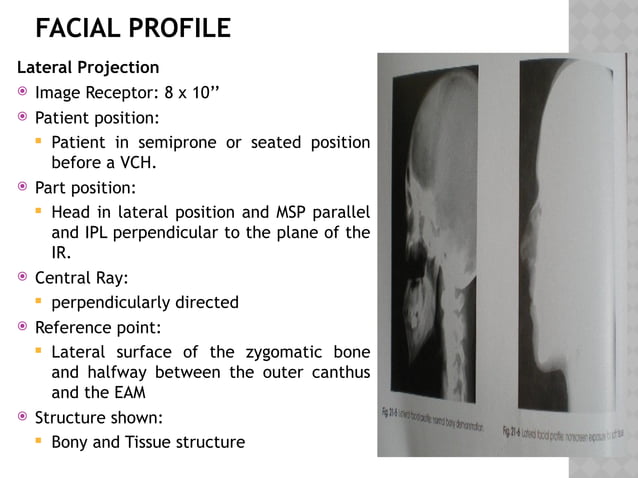 Radiographic positioning II. Skull positioning | PPT