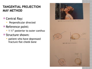 Radiographic positioning II. Skull positioning | PPTX